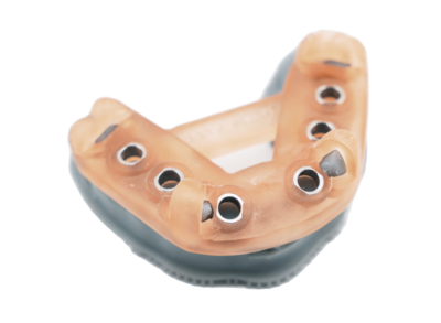 Digital Implant Guide - Surgical Guide by Minimax Implant