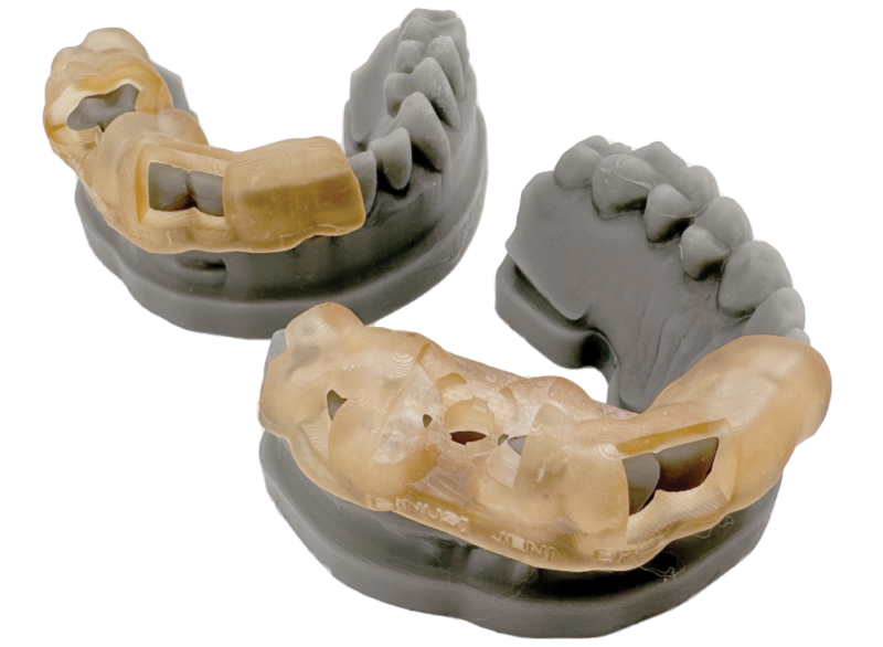 Digital Implant Guide - Surgical Guide by Minimax Implant